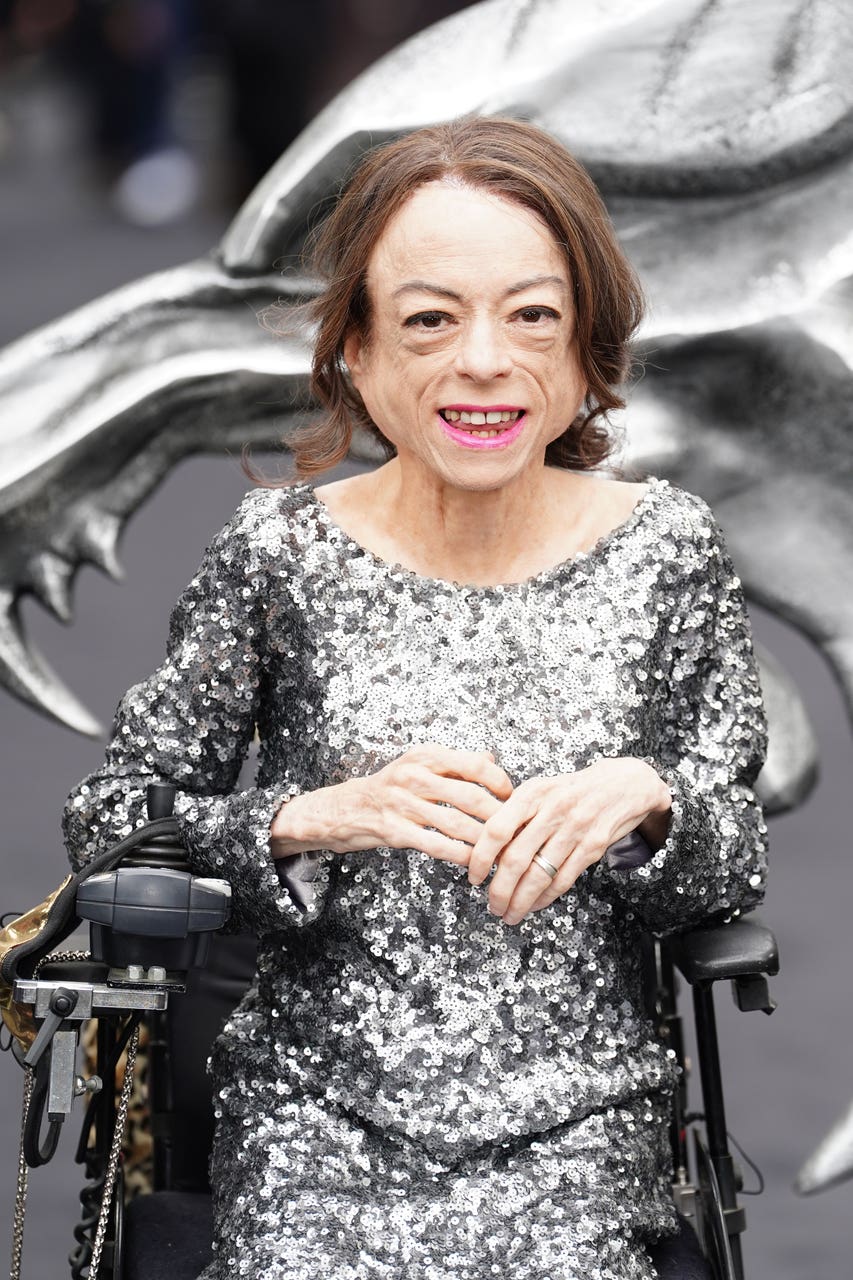 Actress Liz Carr says it hurts to hear her younger self say ‘I’d rather ...