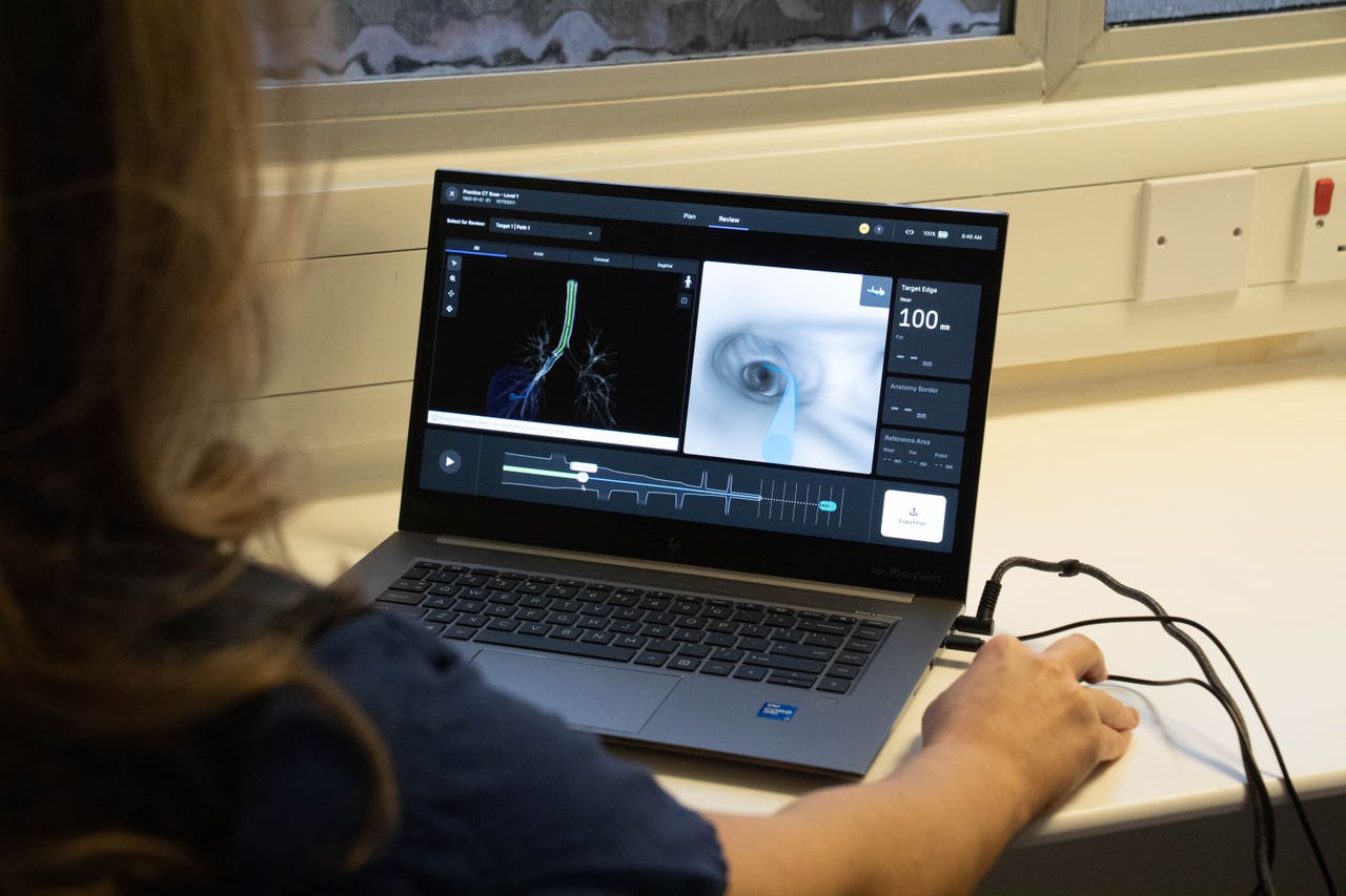 ‘Trailblazing’ NHS pilot combines AI and robotics to spot lung cancer ...