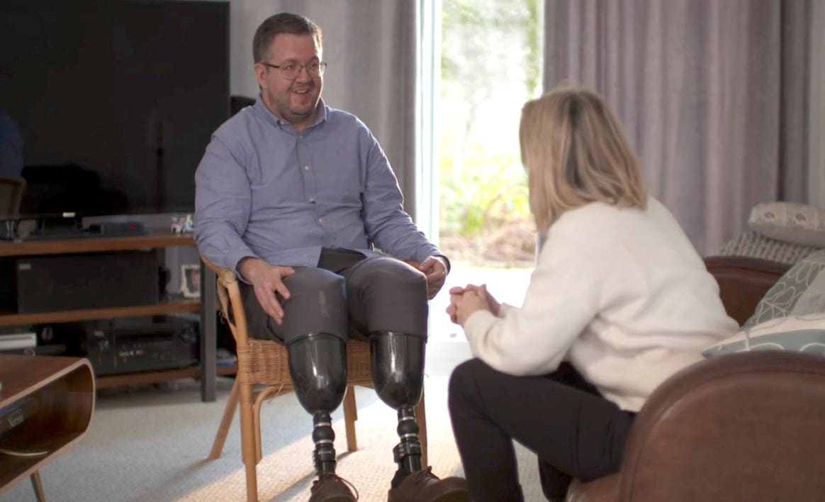 Amputation surgeon back at work after having both legs removed | Slough ...