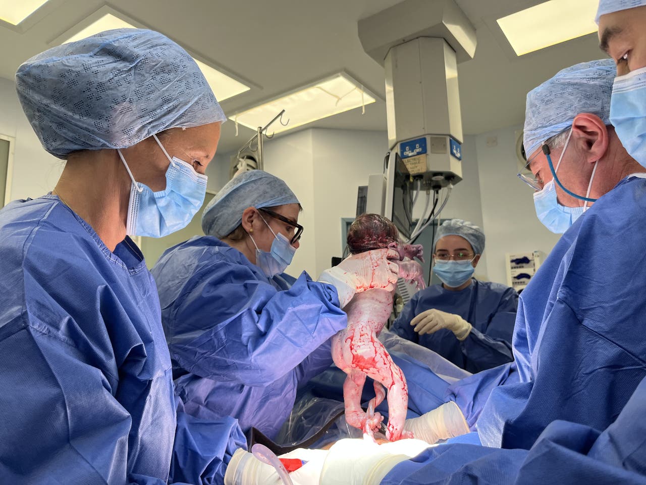 Womb transplant doctors describe moment of joy as baby Hugo entered the ...